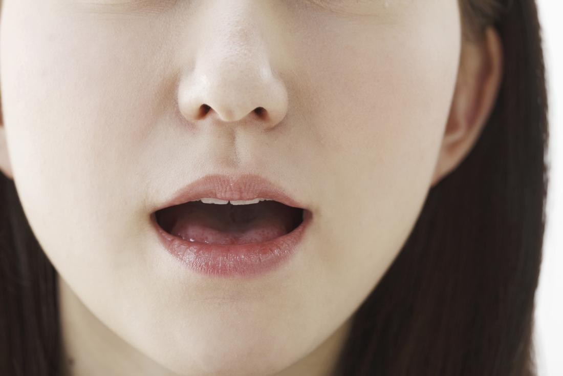 Aphonia and speech problems - VA Benefits Consultants